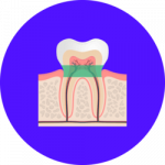 Zahnaufbau – Funktionen, Krankheiten und Behandlung von Zähnen